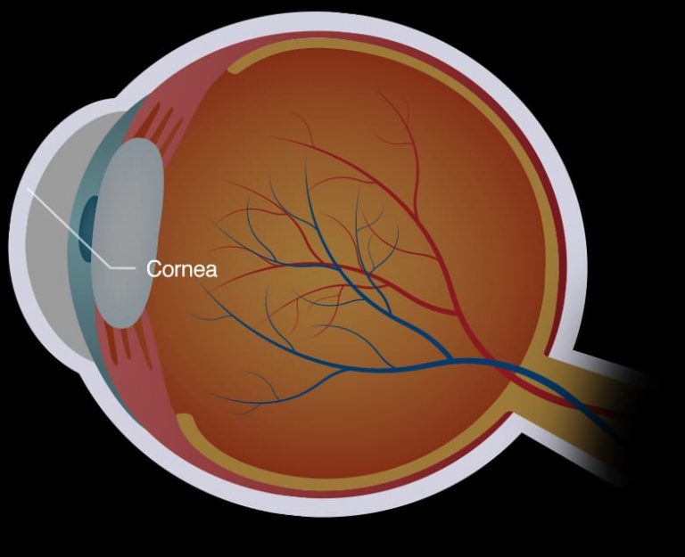 Córnea - Oftalmologista Passo Fundo lentes de contato cirurgia de ...